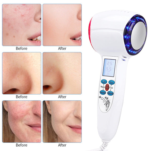 HexoCryo™ At-Home Facial Cryotherapy Device - Hexo Care International